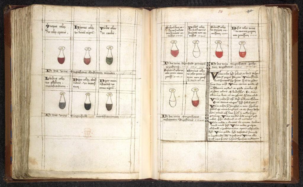 Urine Wheels in Medieval Manuscripts: Discover the Curious Diagnostic ...