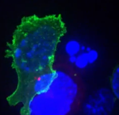 Microscopic Battlefield: Watch as a Killer T Cell Attacks a Cancer Cell ...